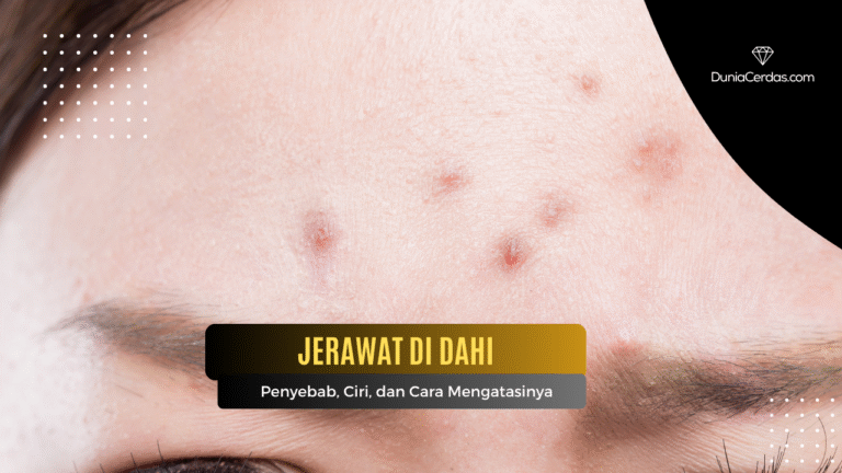 Jerawat di Dahi: Penyebab, Ciri, dan Cara Mengatasinya - Dunia Cerdas